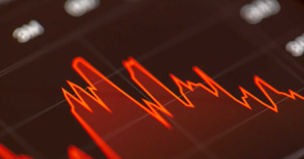 O que é Déficit? Entenda o significado na economia - Dicionário Financeiro